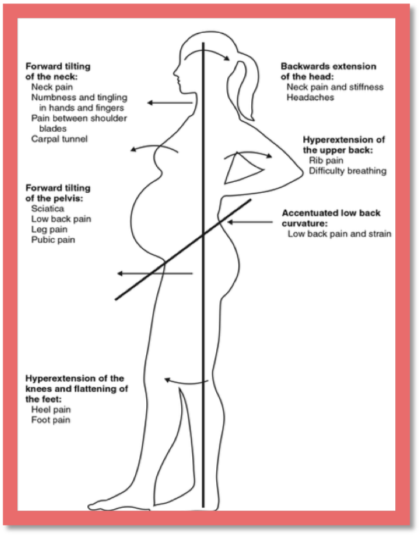 pregnancy-posture-northern-beaches-mums
